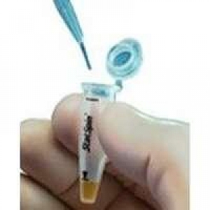 StatSpin Urine Tubes | Medline Industries, Inc.