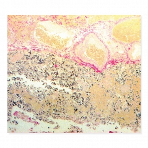 Hall's Bile Stain Kit | Medline Industries, Inc.