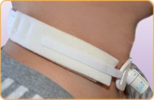 Marpac 1-Piece Tracheostomy Collars | Medline