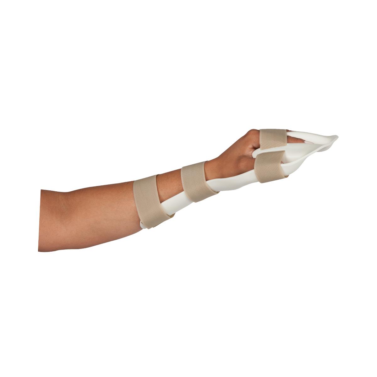 Preformed Volar Splint