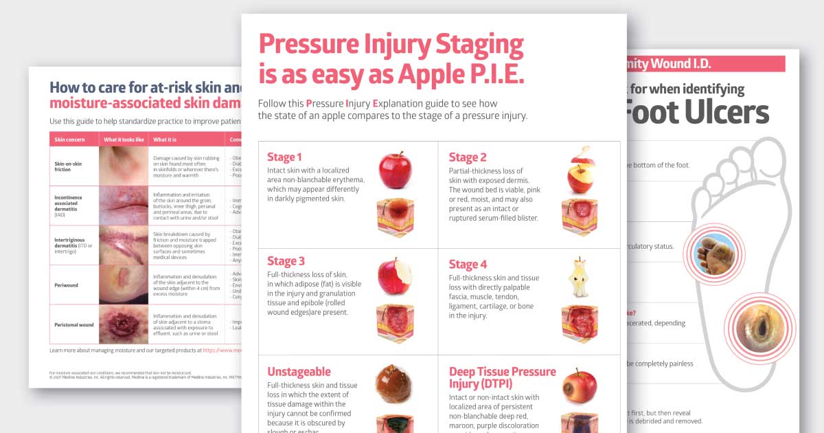 Skin and Wound Care Posters - Medline